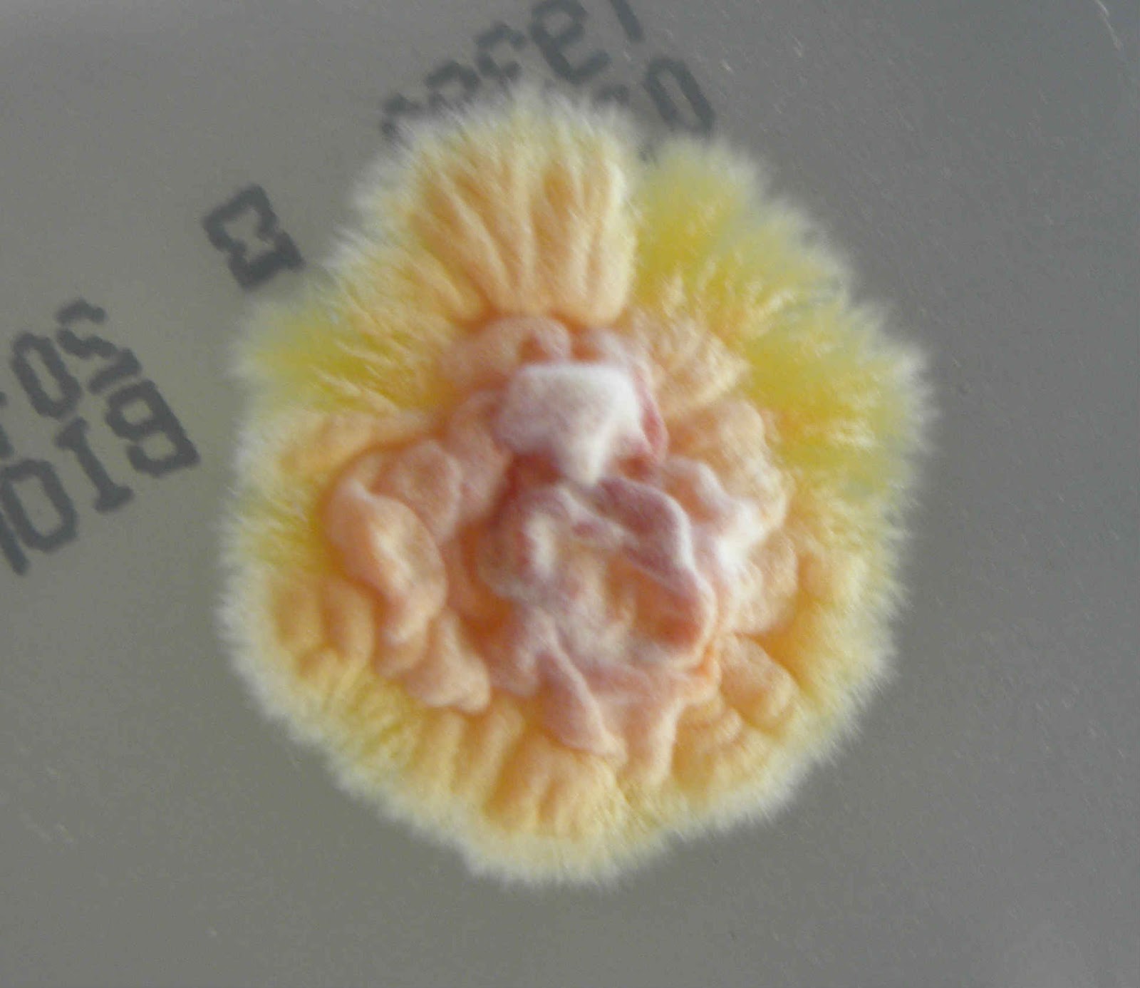 ATLAS MICOLOGIA: TRICHOPHYTON SOUDANENSE