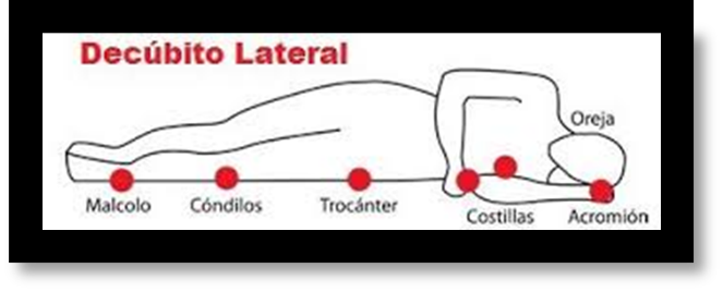 ENFERMERIA ACTUALIZADA: posiciones: decubito lateral,ventral o prona ...