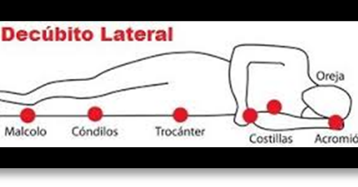 ENFERMERIA ACTUALIZADA: posiciones: decubito lateral,ventral o prona ...