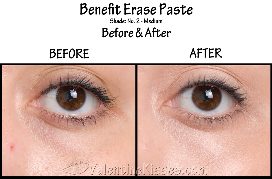 Valentine Kisses: Benefit Erase Paste in No. 2 Medium - before & after ...