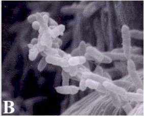 Acetobacter aceti ~ Microbio-Lab