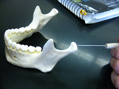 Boned: Human Skull - mandibular condyle (of mandible)
