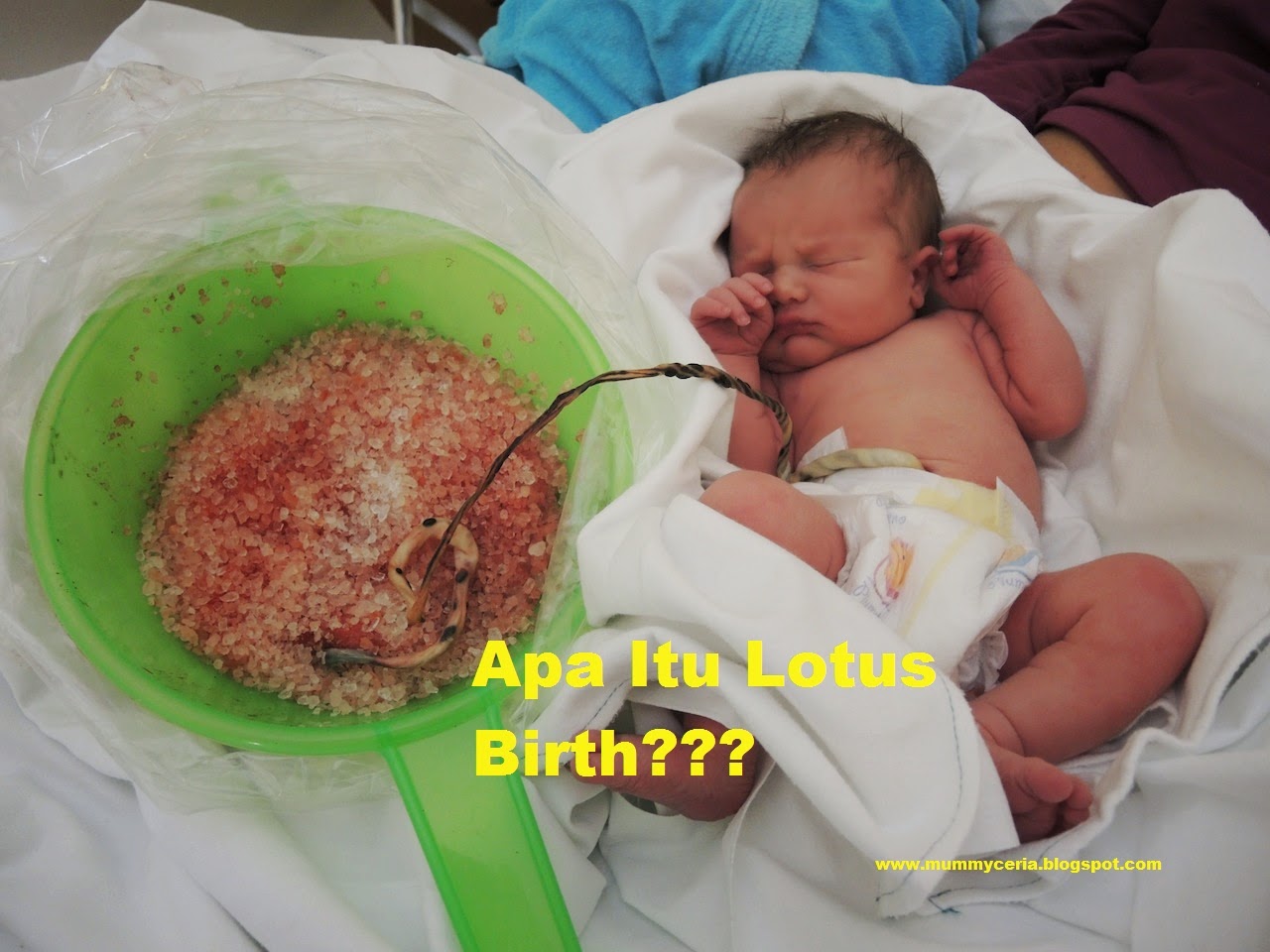 Apa Itu Lotus Birth? - Mummy Ceria