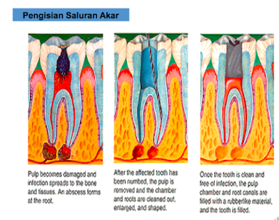 SEMEN DI KEDOKTERAN GIGI