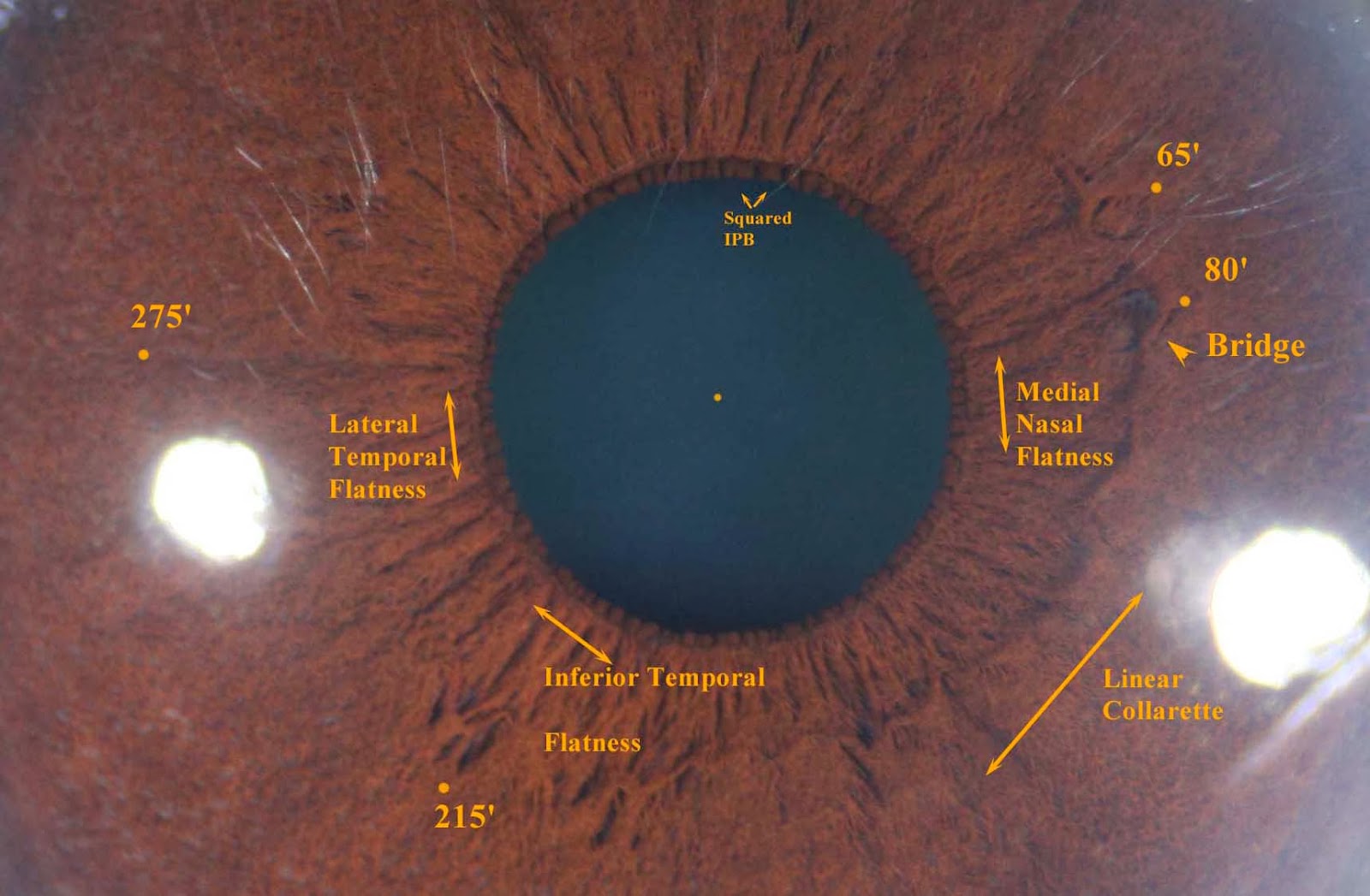 Modern & Multidimensional Iridology: Common Practice in Modern ...
