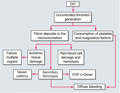 Disseminated Intravascular Coagulation; Consumption Coagulopathy