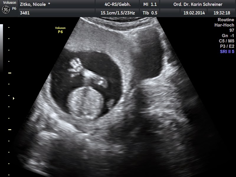 SiNiZi-BLOG: SSW 15+1