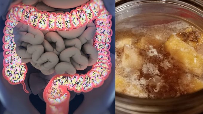 Restaure sua flora intestinal com os probióticos naturais desta fruta