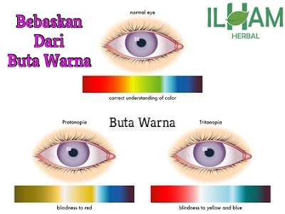 Bebaskan Buta Warna Secara Tradisional