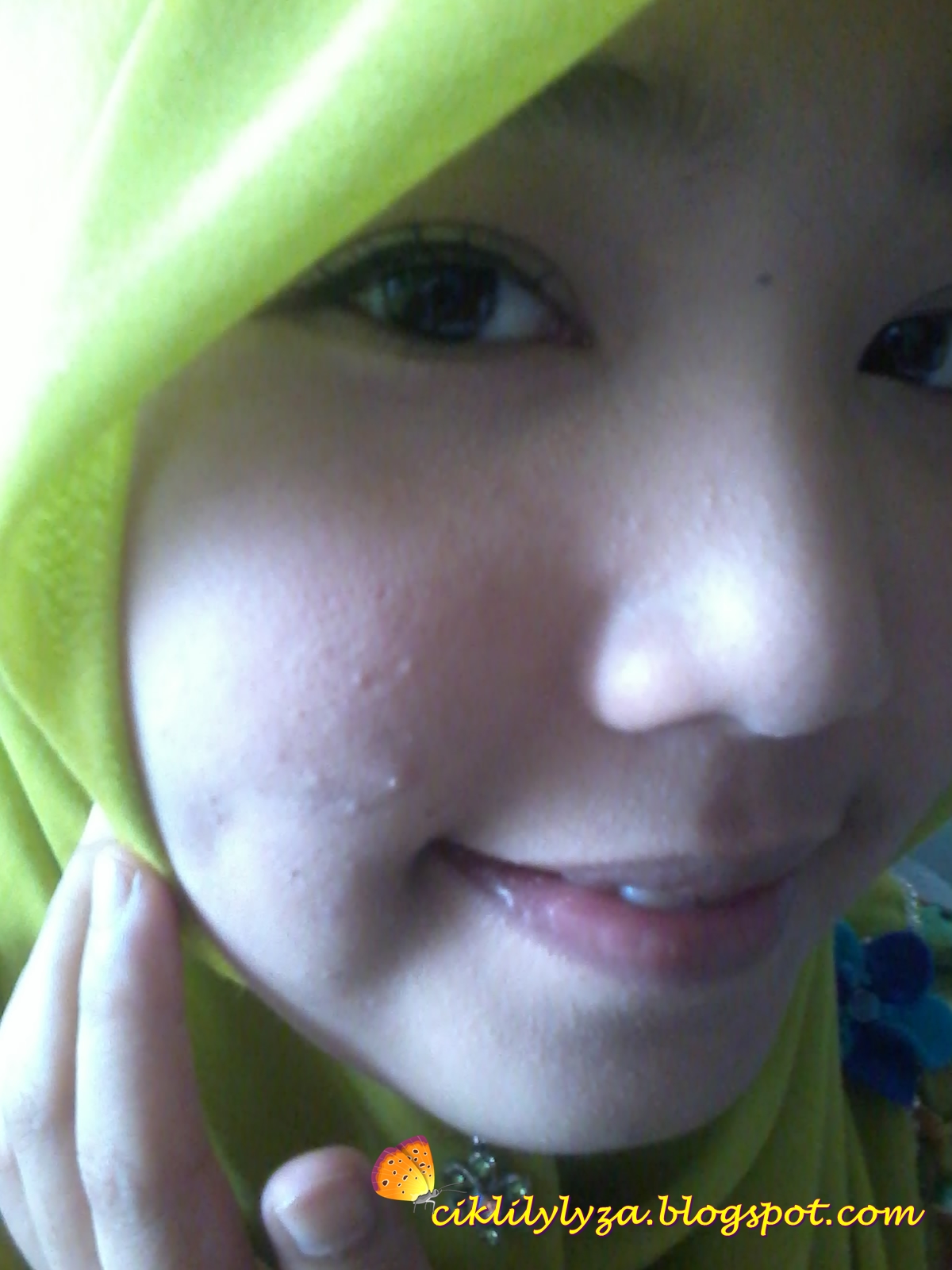 Cik Lily Lyza : TESTIMONI Dnars skincare