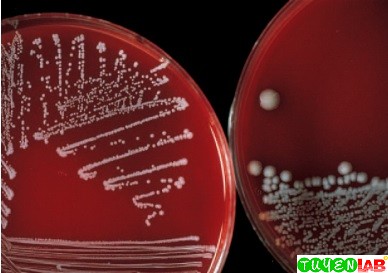 [Microbiology] Use of Colonial Morphology for the Presumptive ...