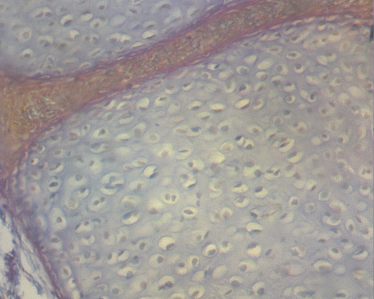 CARTILAGOS Y HUESOS: cartilagos y huesos