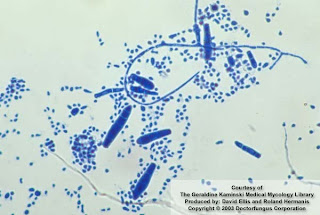 Trichophyton mentagrophytes ~ Examination and Happiness