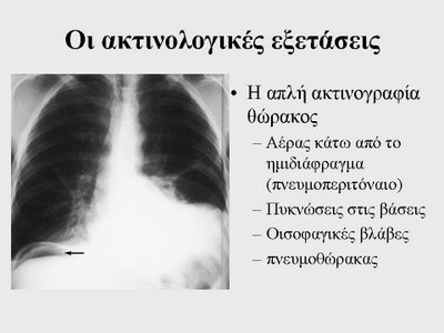 ΑΓΆΠΗ ΓΙΑ ΖΩH: ΟΞΕΙΑ ΚΟΙΛΙΑ