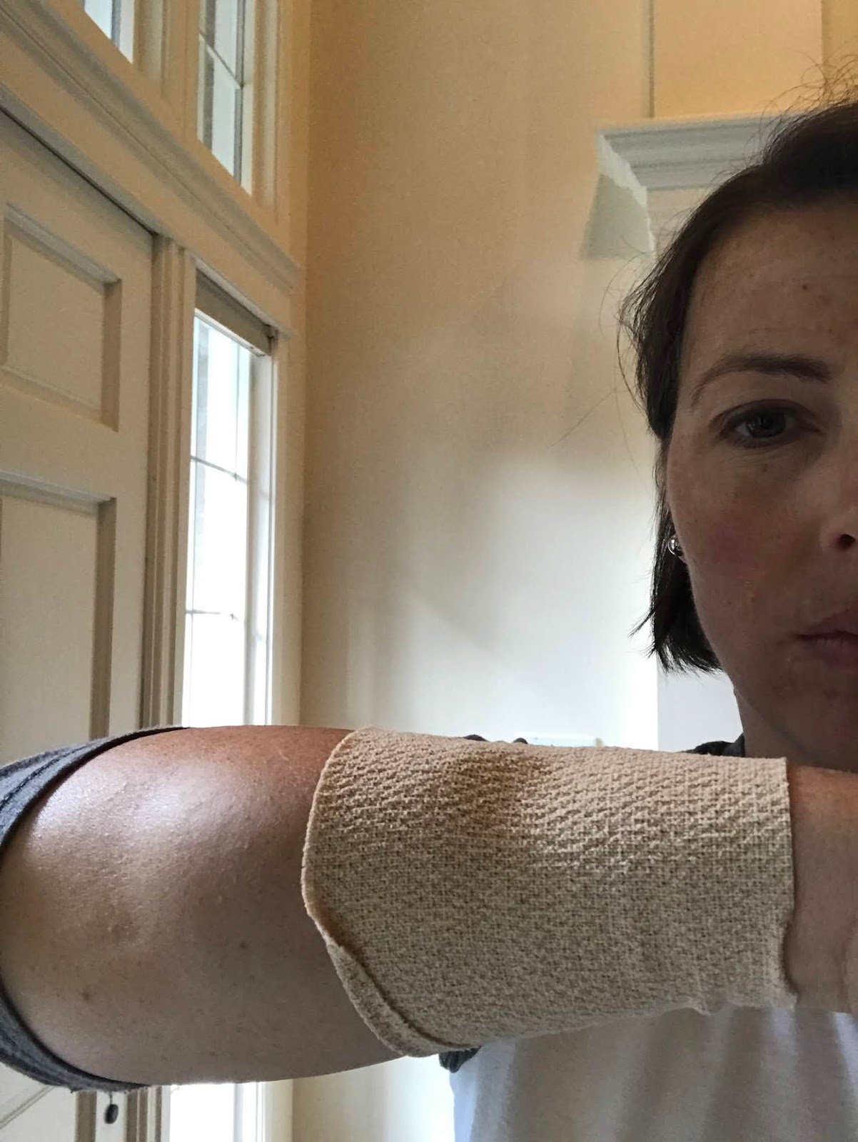 Living in the Moment: Skin Cancer Take 2 {Gory Pics Included)