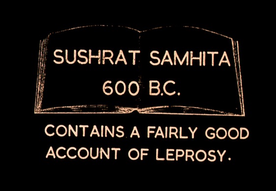 PUBLIC HEALTH: LEPROSY (MORBUS HANSEN)