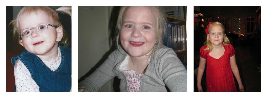 Kayli is Loving Life Trisomy Style!!!: Trisomy 11