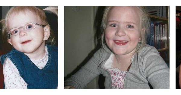 Kayli is Loving Life Trisomy Style!!!: Trisomy 11