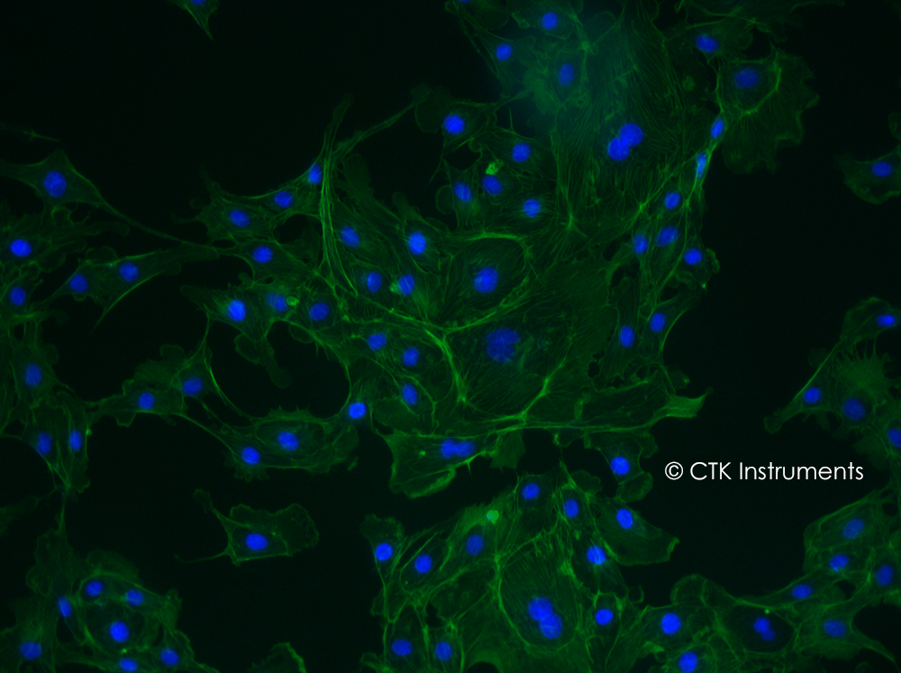 Microscope World Blog: Fluorescence Microscopy Camera