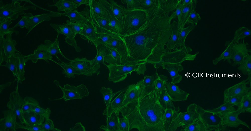 Microscope World Blog: Fluorescence Microscopy Camera