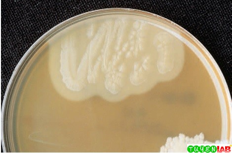 [Microbiology] Atlas of Anaerobes of Clinical Importance | Free Medical ...