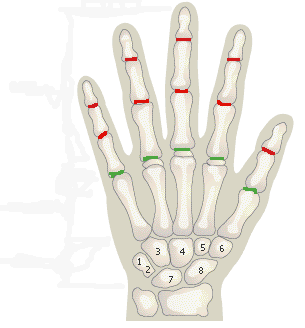 ¿Por qué crujen los huesos?