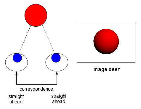 Squinty Josh: Abnormal retinal correspondence - new and improved!
