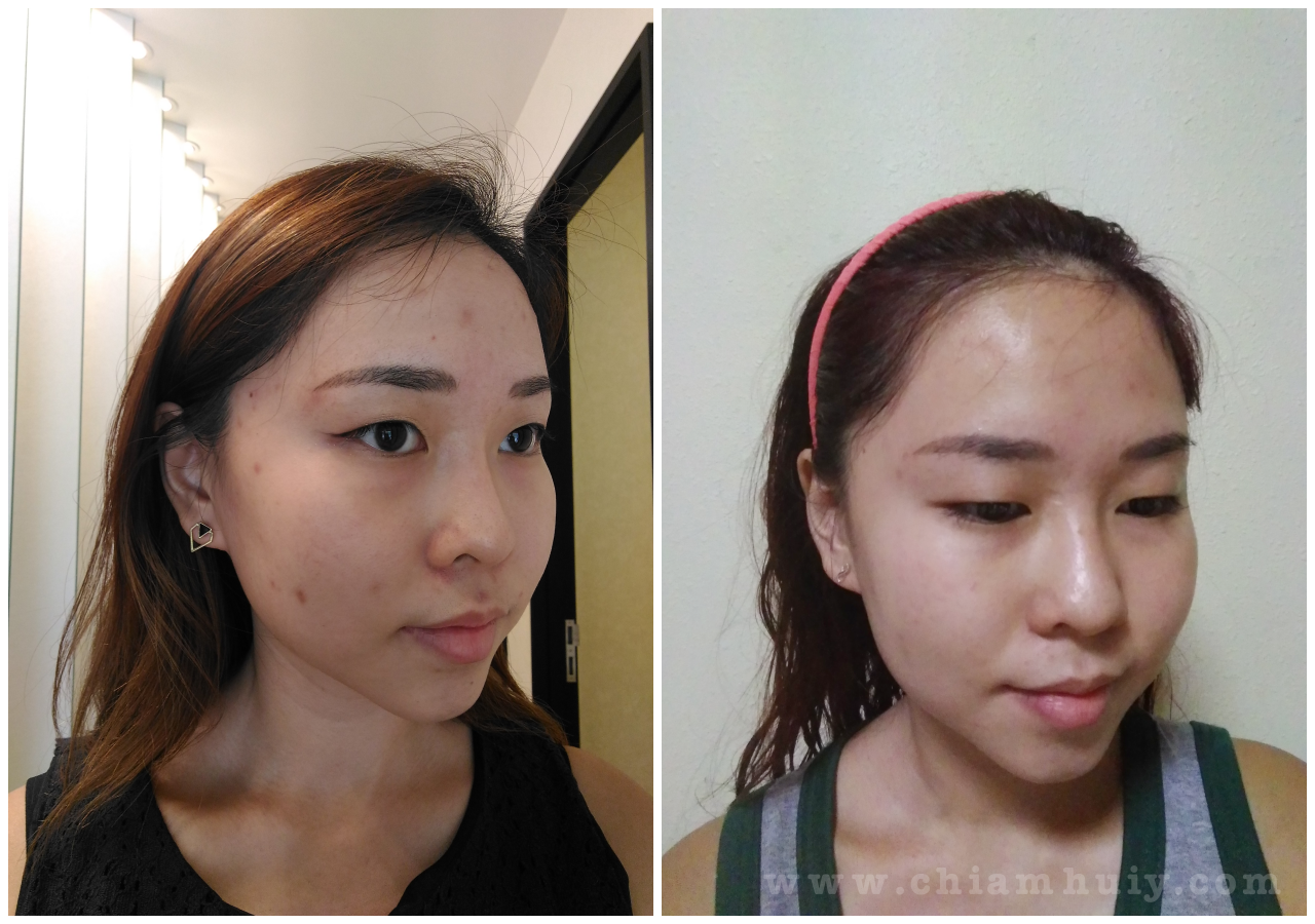 Ceramiracle - Ceramides Skin Supplement Singapore Review - Celine Chiam ...