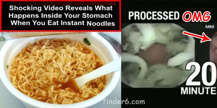 What Happens Inside Your Stomach When You Eat Instant Noodles ...
