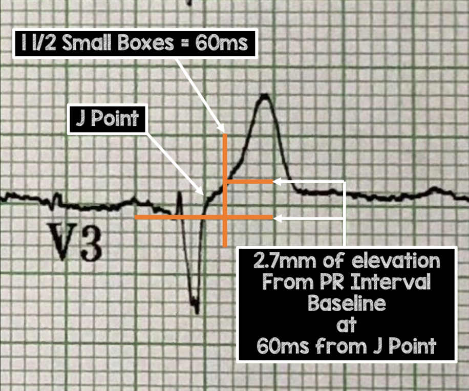Dr. Smith's ECG Blog