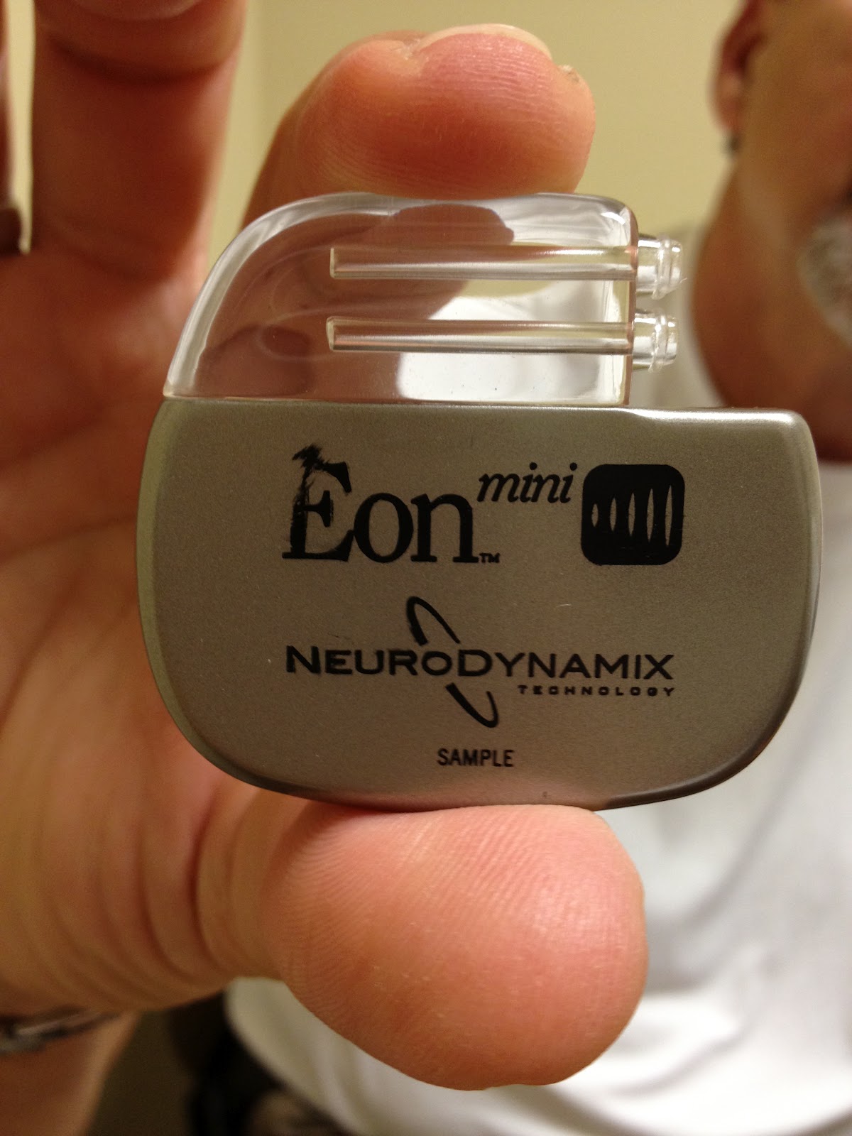 My Spinal Cord Stimulator Journey: Three Week Check