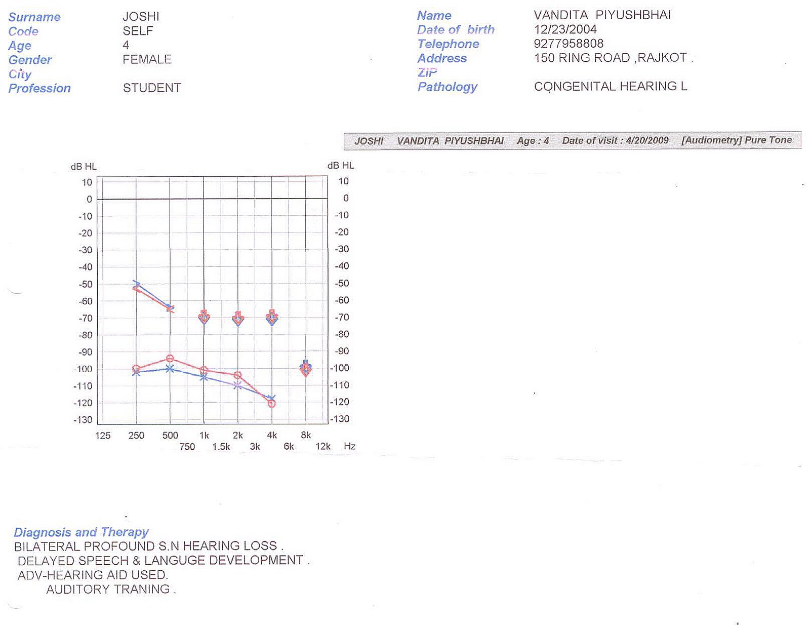 Vandita Can Talk: Vandita's Audiogram Before and After Cochlear Implant