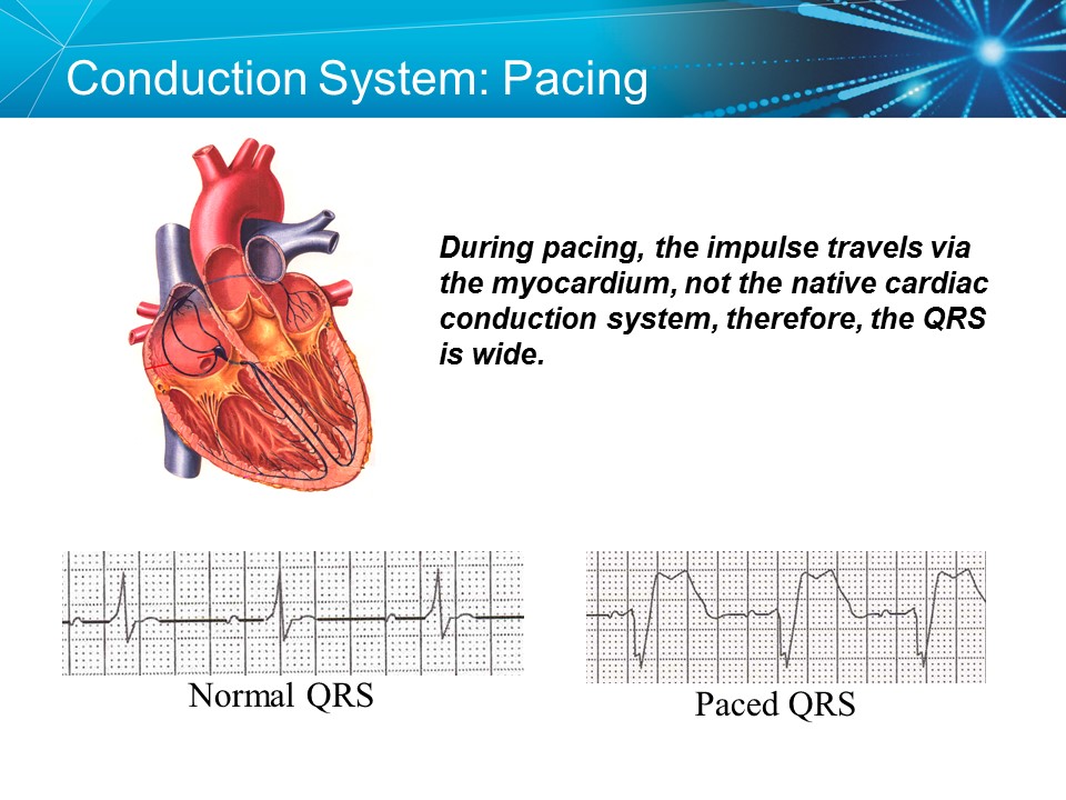 CVT Mohd Farid: Pacemaker Follow Up Part II-Medtronic Academy
