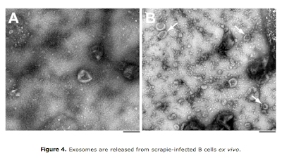 Rule of 6ix: #openaccess: Exploitive prions versus your innocent immune ...