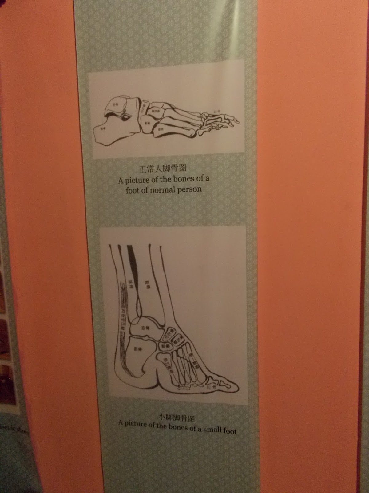 Dragon by the Tail: Ancient Chinese practice of foot binding