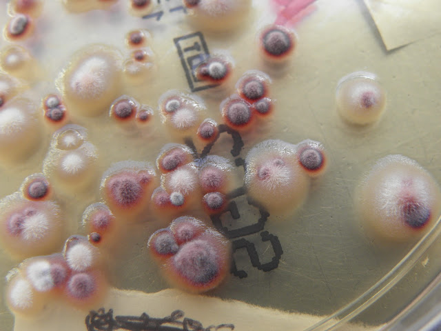 ATLAS MICOLOGIA: TRICHOPHYTON VIOLACEUM