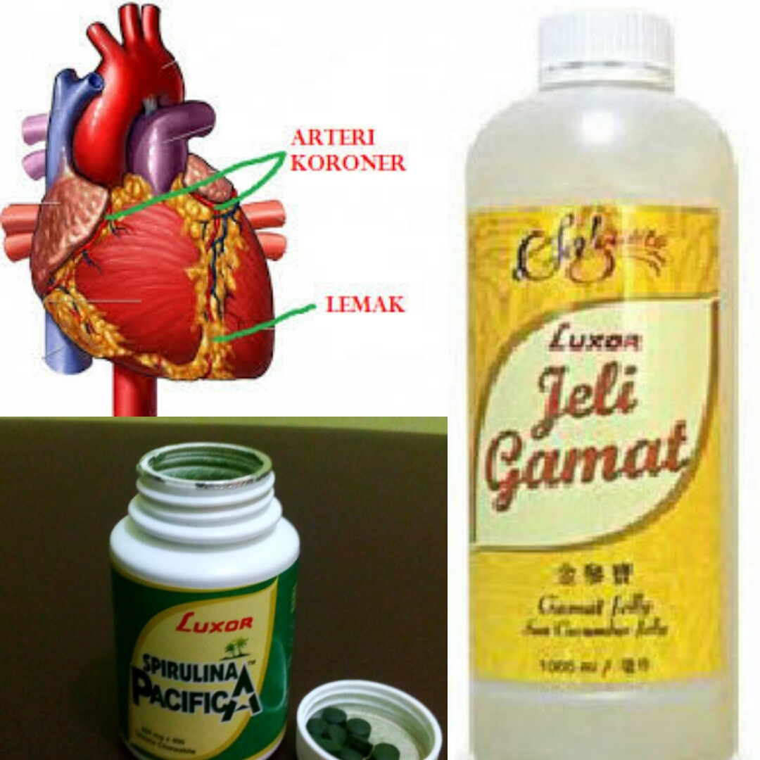 Pengobatan Penyakit Jantung Secara Alami