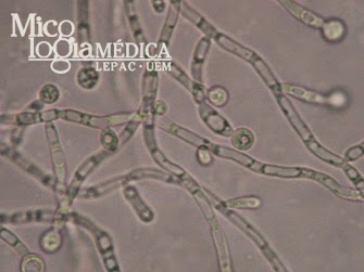 PARA TÉCNICOS DE LABORATORIO: Prueba de la Optoquina