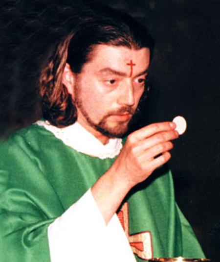 Amazing wonderful real stigmata cases - twenty ranking