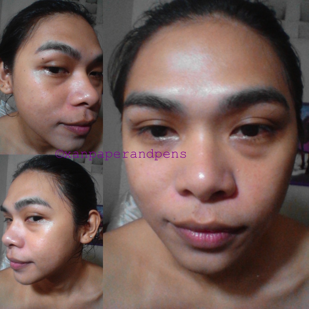 xanPaper and Pens: What is Acne Purging?