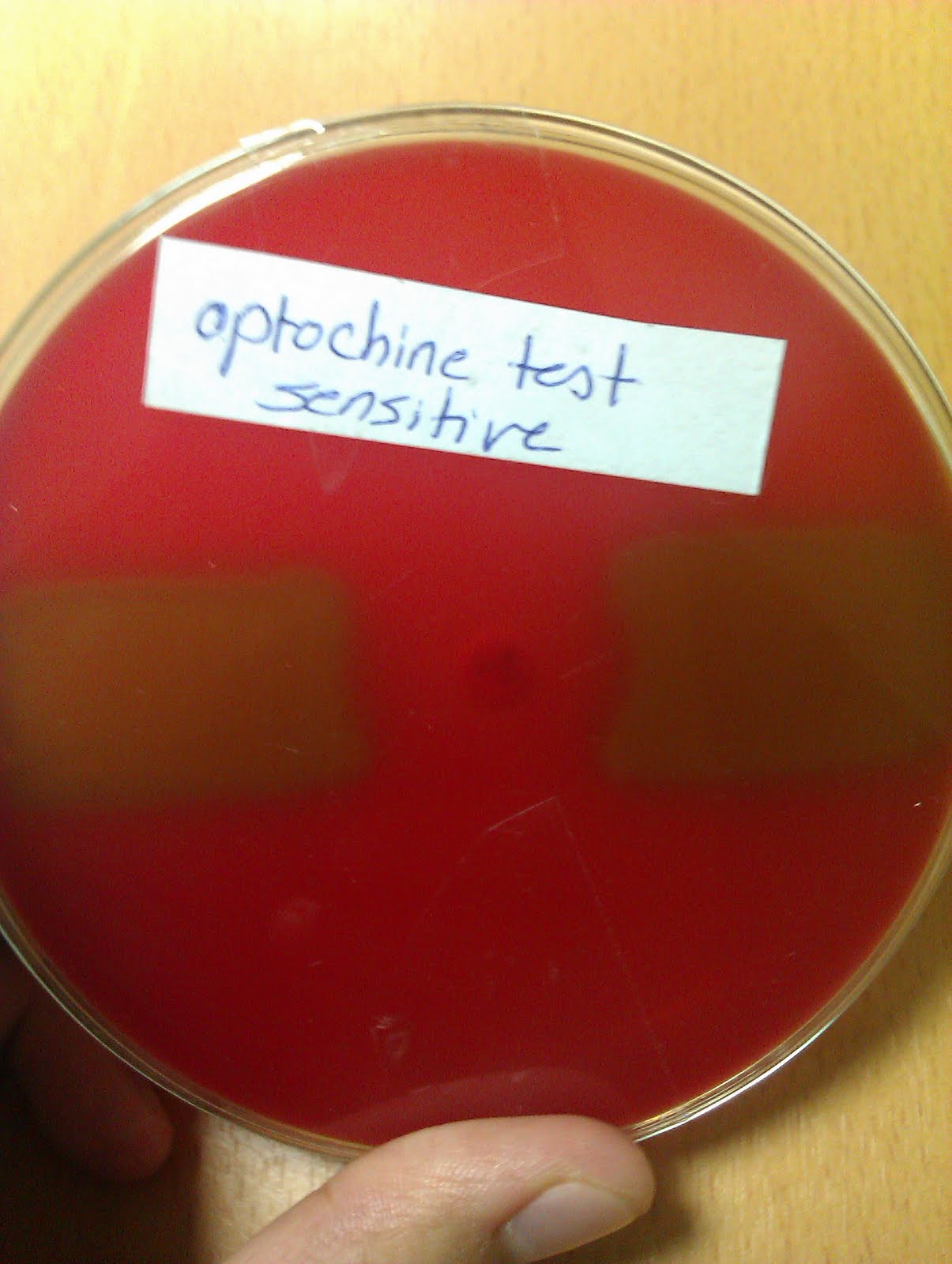 tamaniyah tibb team :): microb RS