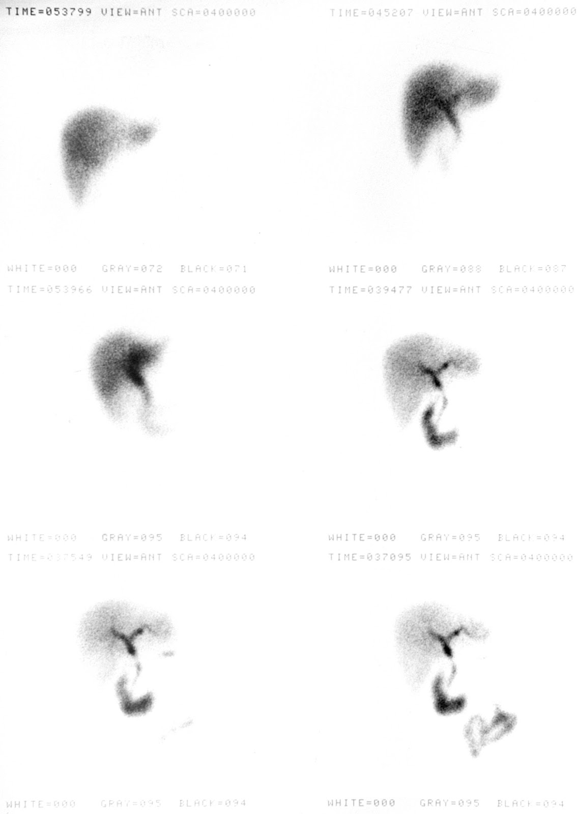 Pathology Cases: GI3 Case B Answers