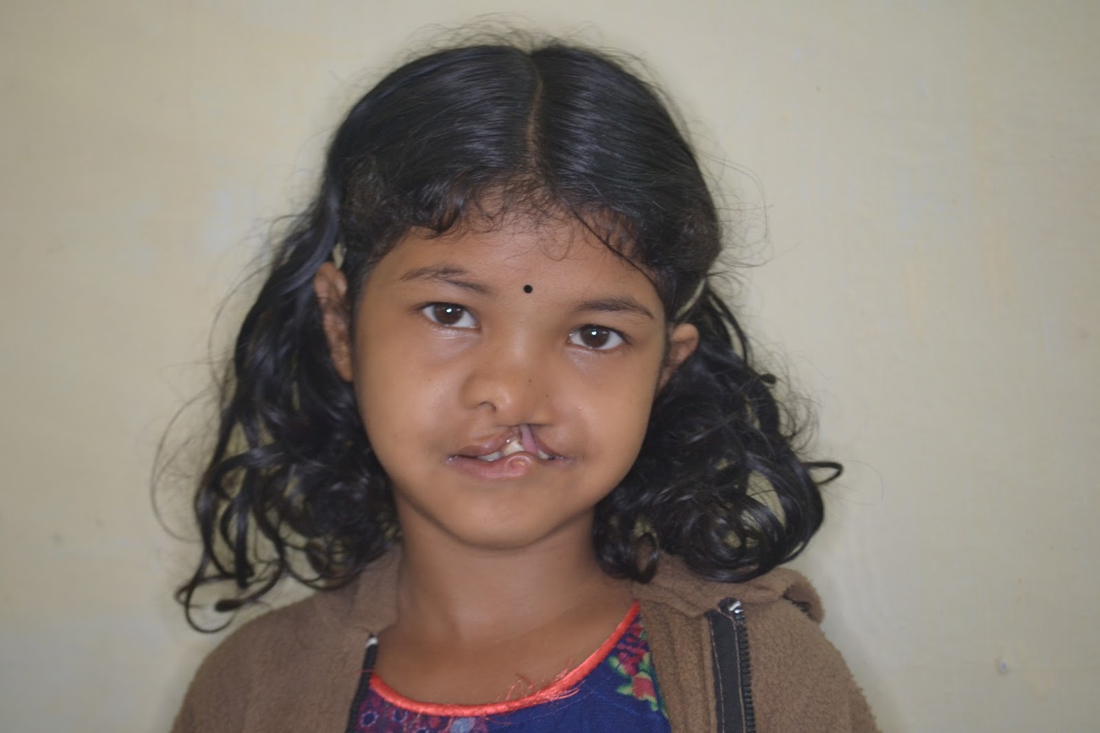 Welcome to EduledgeAsia : 35K KIDS ARE BORN WITH CLEFT LIP, PALATE A ...