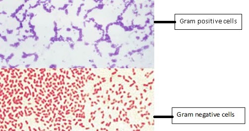Gram Staining Procedure | Learn Microbiology