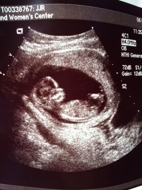 Bump to Baby: 13 Weeks