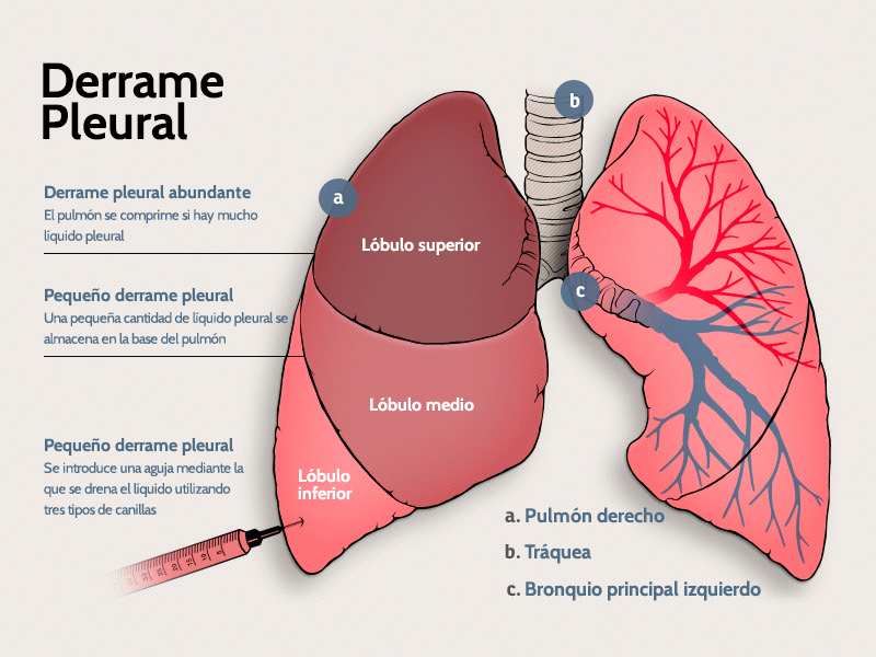 ANATOMIA,FISIOLOGIA Y PATOLOGIAS RESPIRATORIAS: Sistema Respiratorio ...