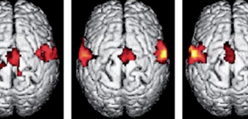 Pentru Suflet: 5 mari mistere ale creierului uman!