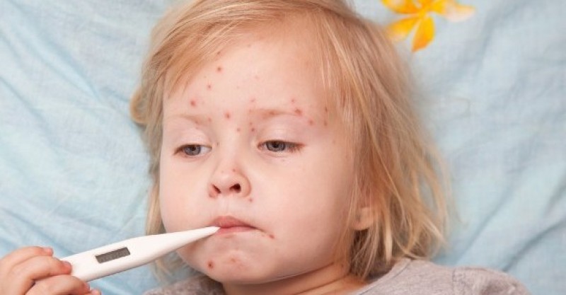 Cara Mengobati Penyakit Secara Alami: Tips Alami Memulihkan Penderita ...