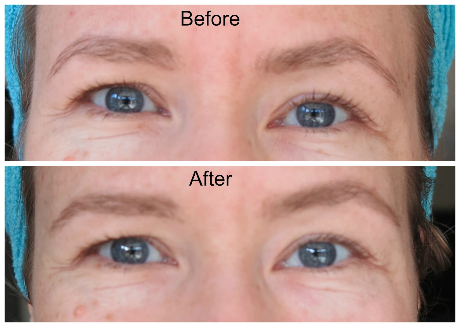 RODAN + FIELDS REDEFINE REGIMEN REVIEW | FOR THE APPEARANCE OF LINES ...