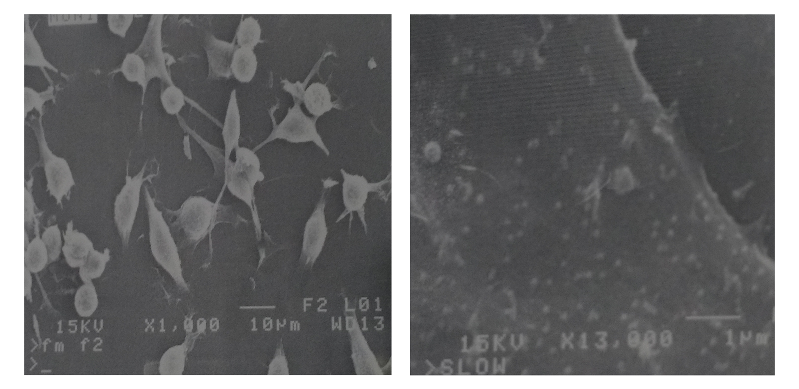Multiple Sclerosis Research: What Did the B Cell Video Miss? Multiple Sclerosis Research: What Did the B Cell Video Miss?